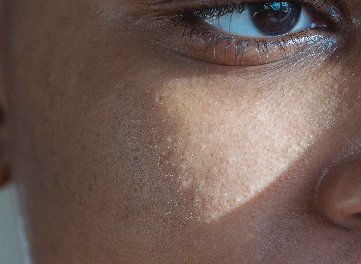 8 Step Best Skin Care Routine for Women-of-Color with Dry Skin – Beauty ...